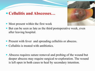 Post op....infection , oliguria, dvt.. | PPTX | Infectious Diseases ...