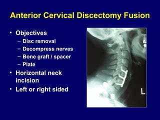 postoperative care of cervical and lumbar spine surgeries | PPT