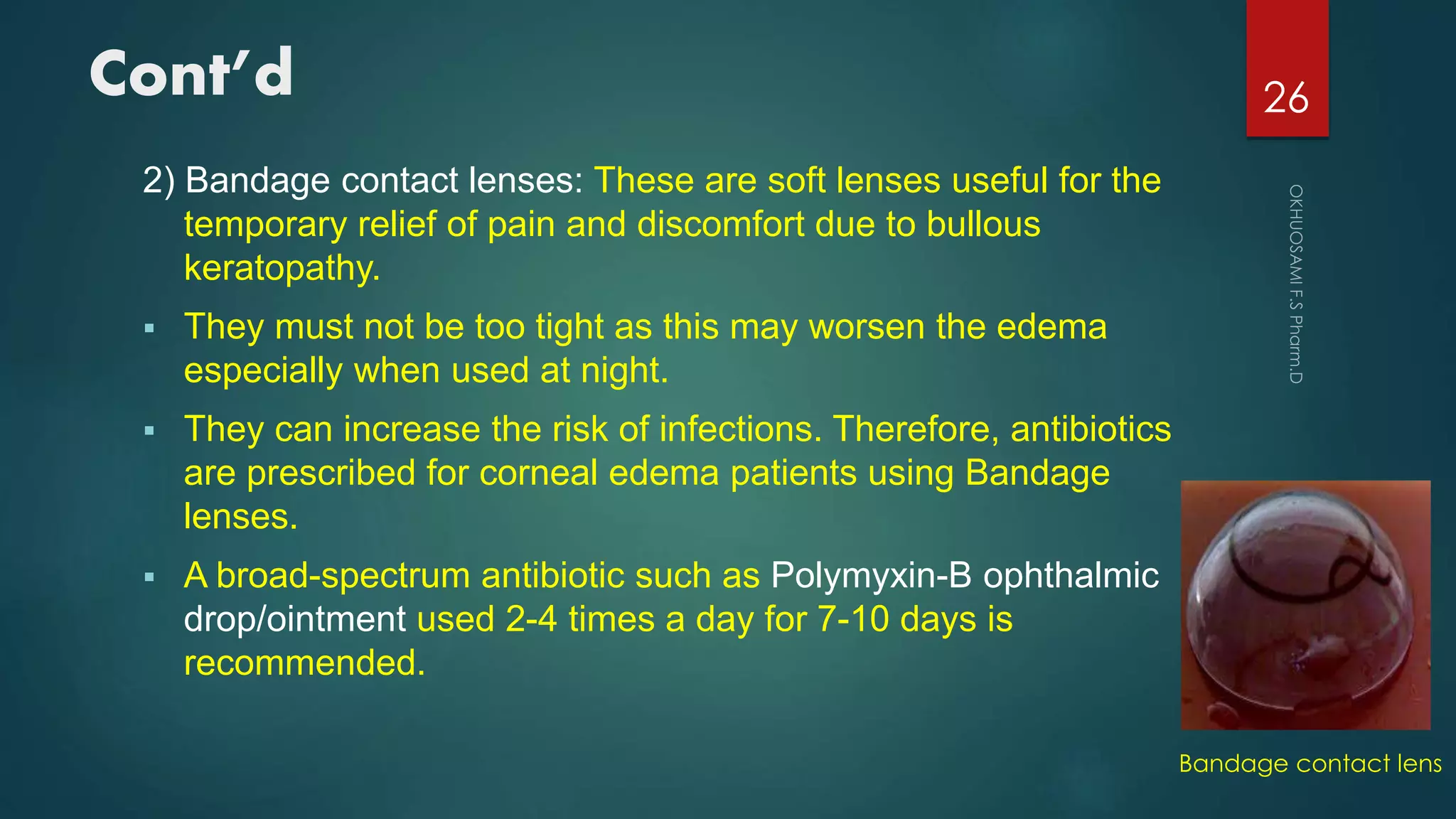 Post operative-corneal-edema | PPTX