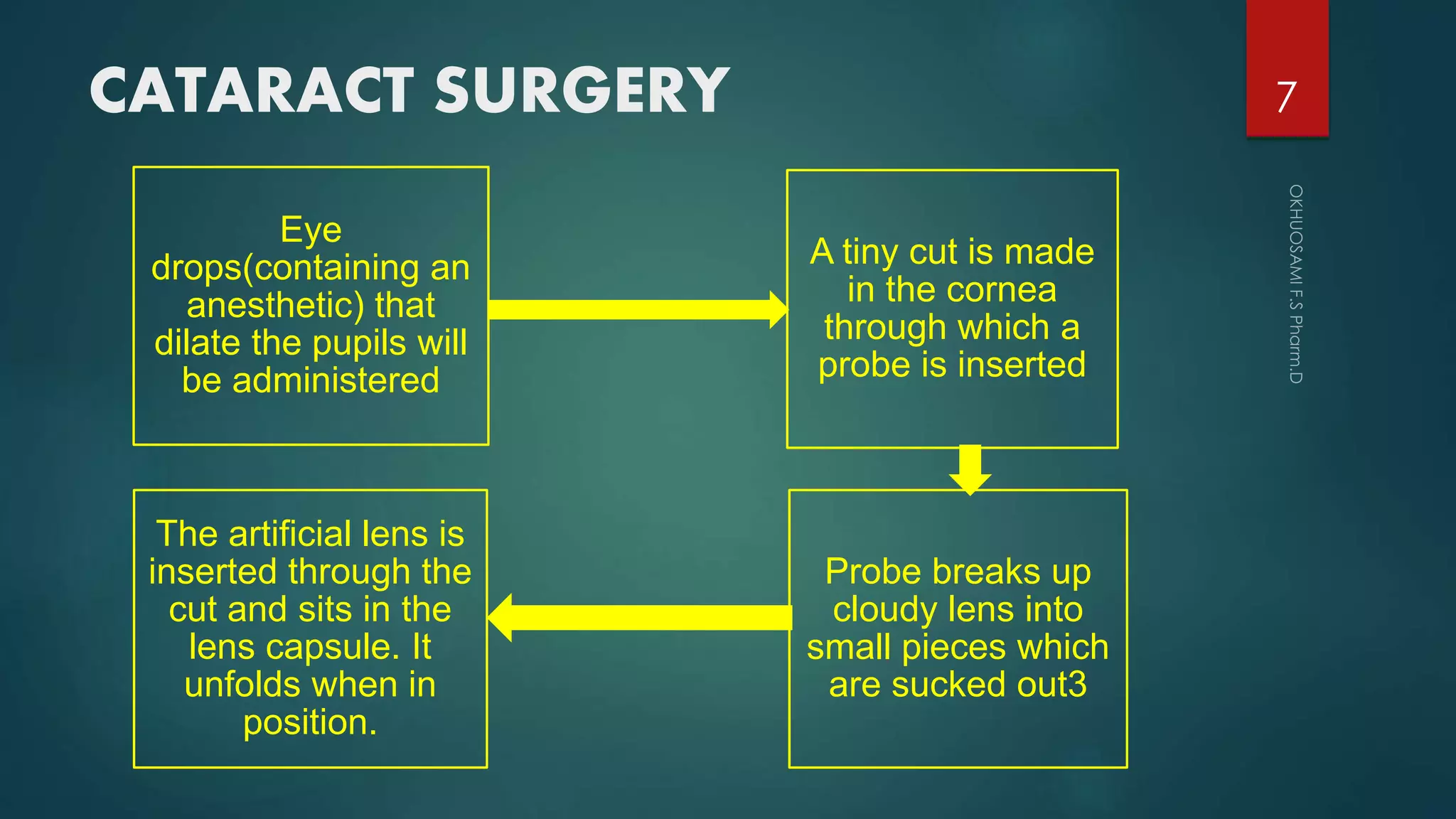 Post operative-corneal-edema | PPTX