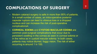 Post operative-corneal-edema | PPTX