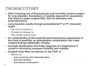 Post operative chest by Dr. Sundar Suwal | PPTX