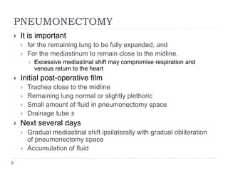 Post operative chest by Dr. Sundar Suwal | PPTX