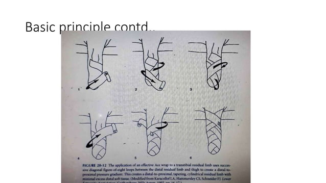 POST-OPERATIVE DRESSING CARE (part2).pptx