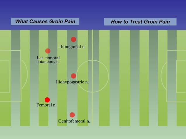 Post-op Herniorrhaphy Pain: What Causes it and How Do We Treat It ...