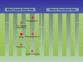 Post-op Herniorrhaphy Pain: What Causes it and How Do We Treat It? | PPT