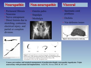 Post-op Herniorrhaphy Pain: What Causes it and How Do We Treat It? | PPT
