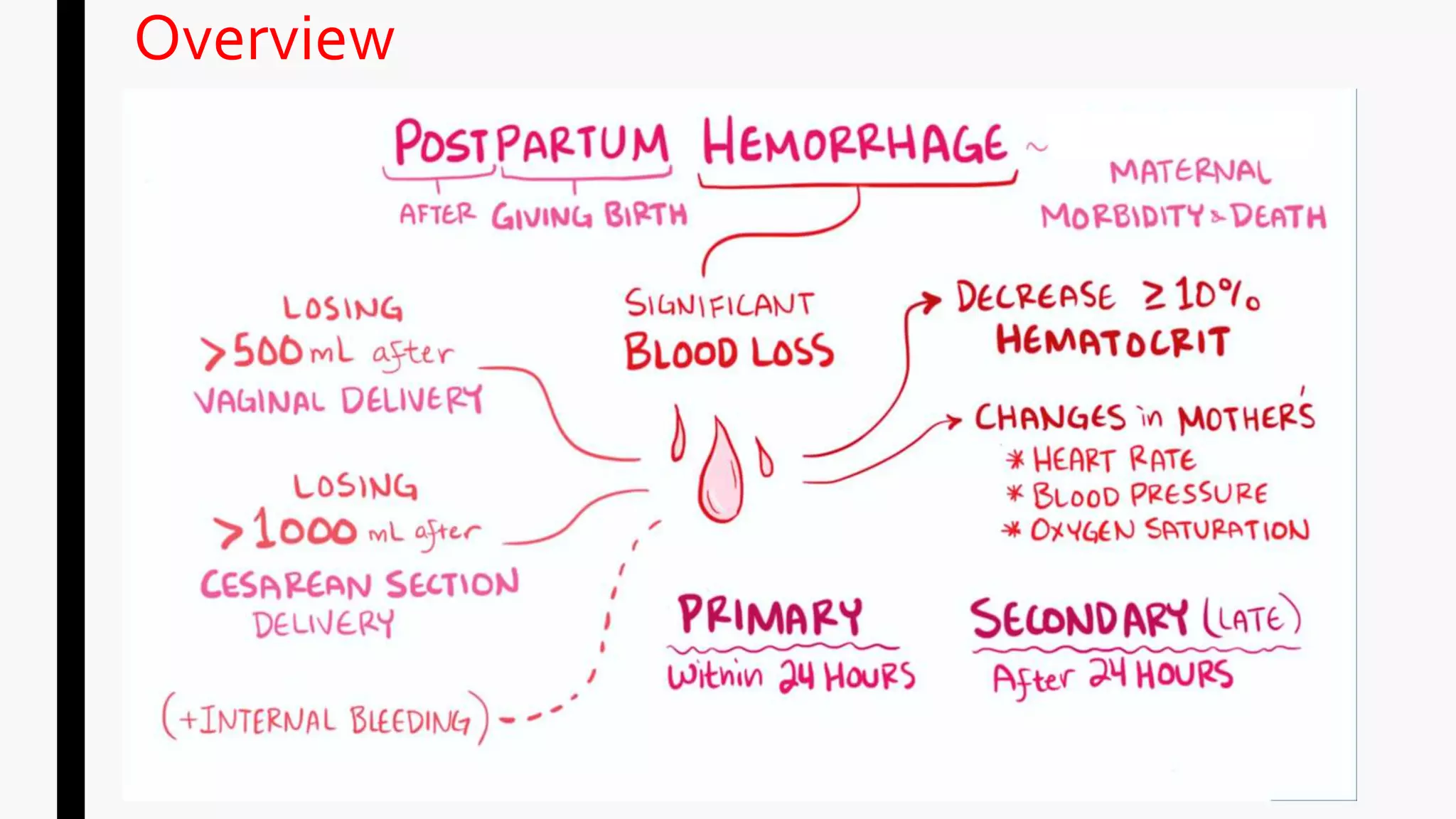 Post partum hemorrhage LB | PPT