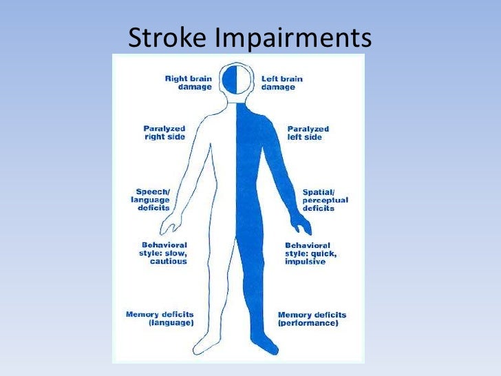 Post stroke depression