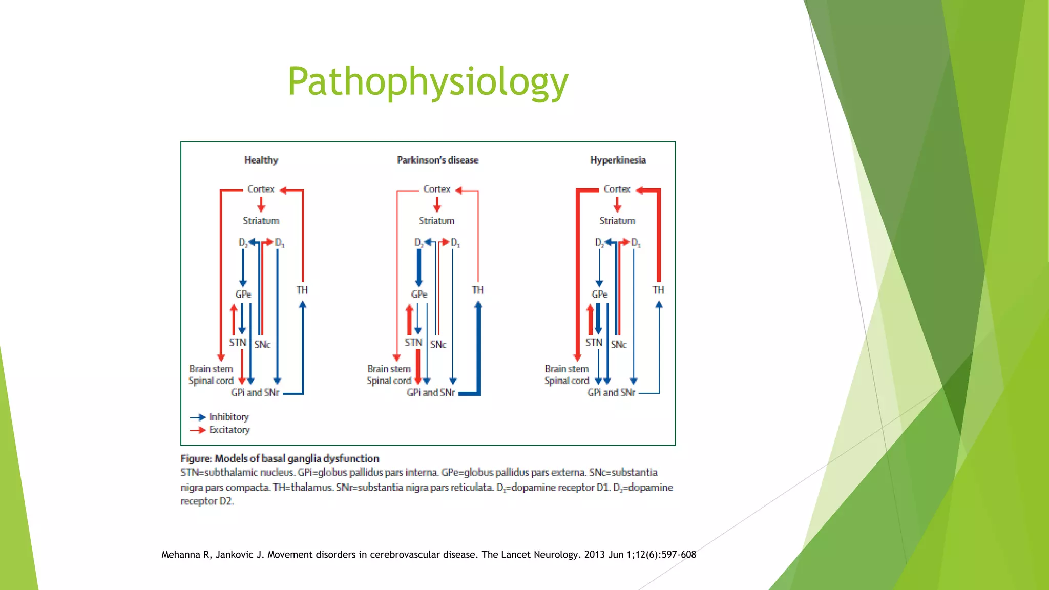 Post-stroke Movement Disorders | PPTX
