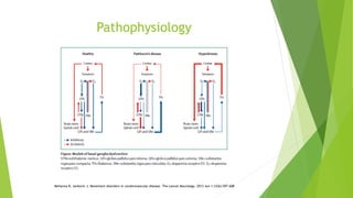 Post-stroke Movement Disorders | PPT
