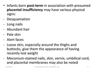 Post-Term Infants and LGA.pdf | Pregnancy | Reproductive Health