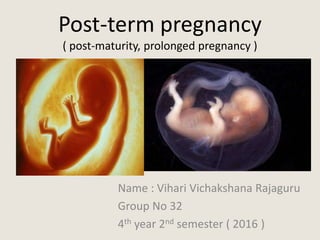 Post term pregnancy | PPTX