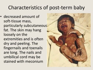 Post term pregnancy | PPT