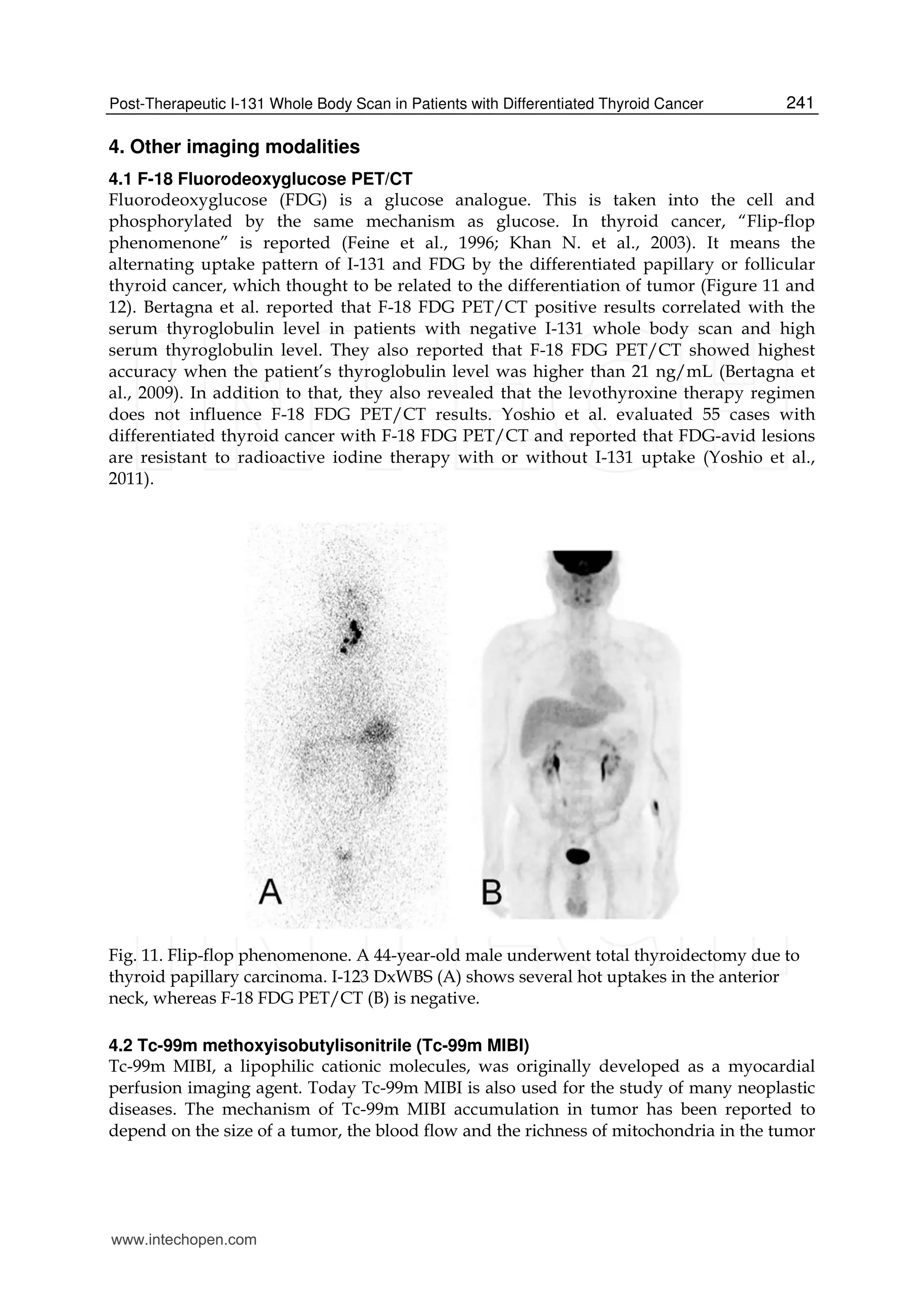 Post therapeutic i-131 whole body scan in | PDF