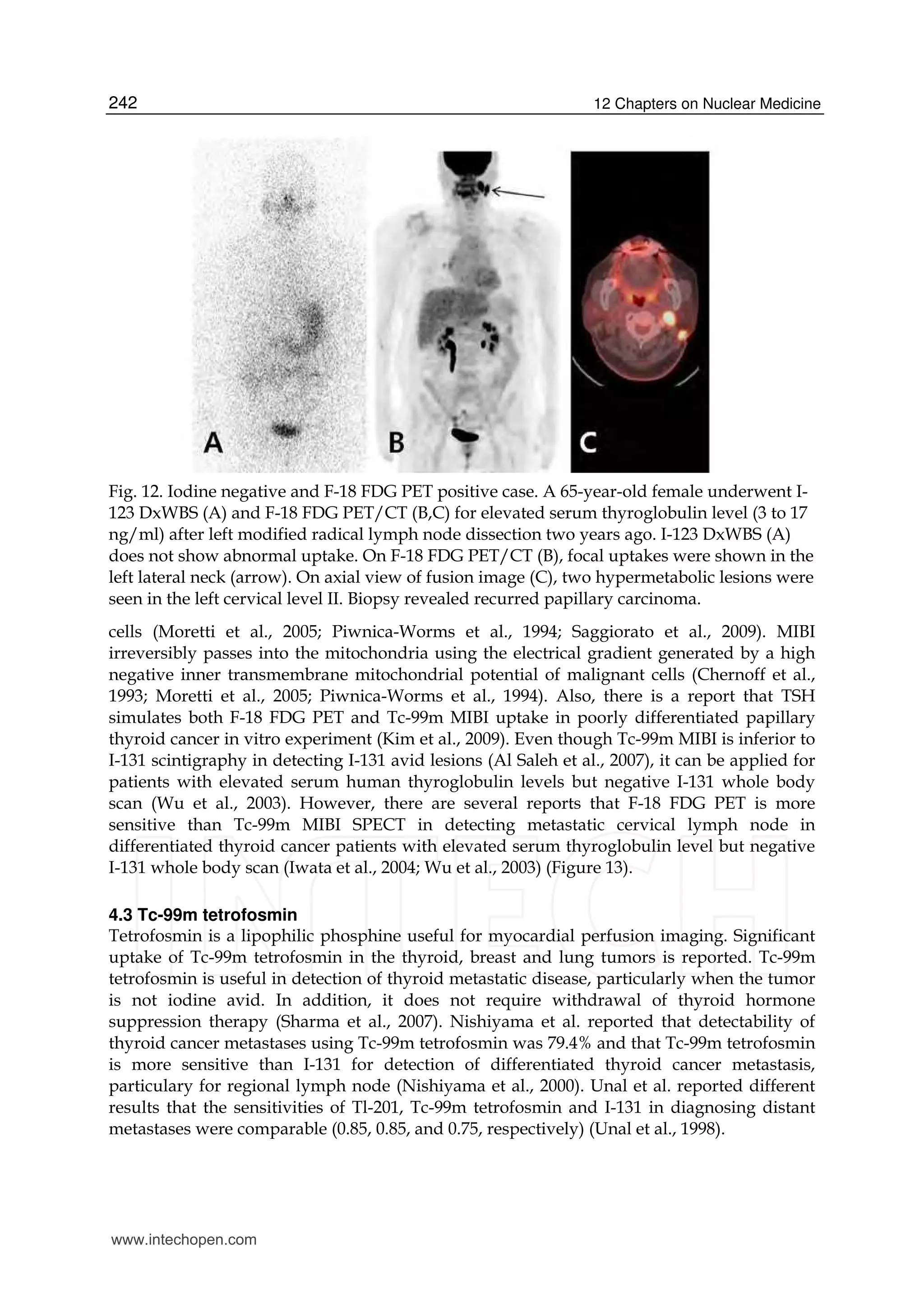 Post therapeutic i-131 whole body scan in | PDF