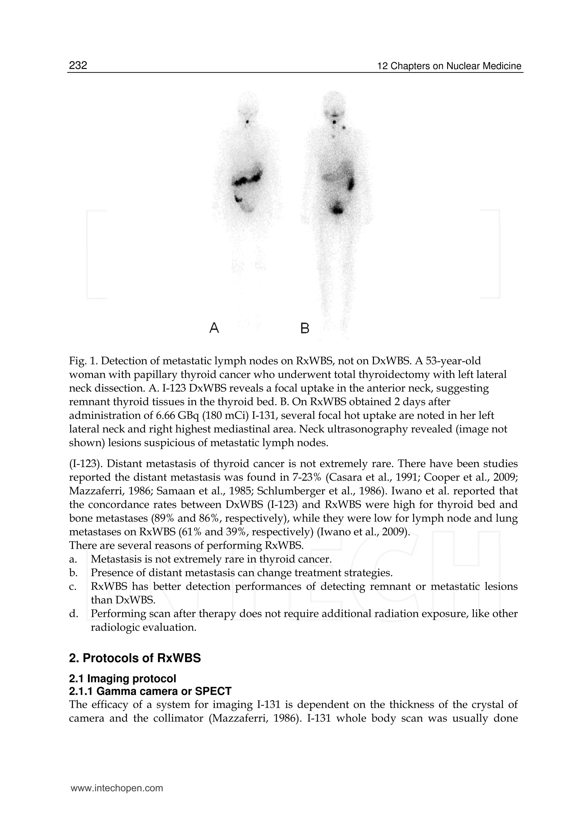 Post therapeutic i-131 whole body scan in | PDF