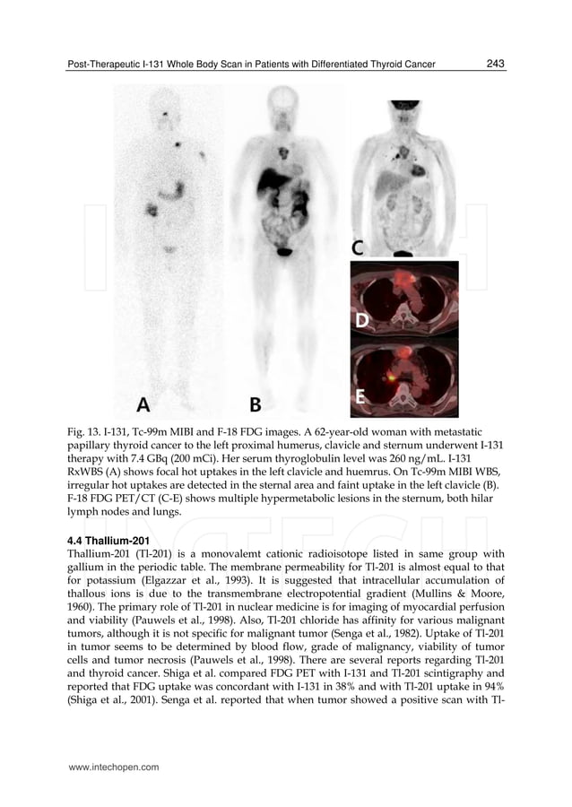 Post therapeutic i-131 whole body scan in | PDF | Thyroid Disorders ...