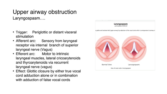 Post anaesthesia discharge criteria and complications | PDF