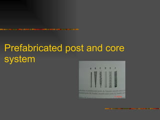 Post and core | PPT