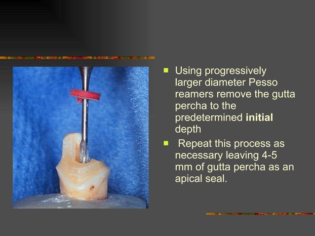 Post and core | PPT | Oral care | Personal Care