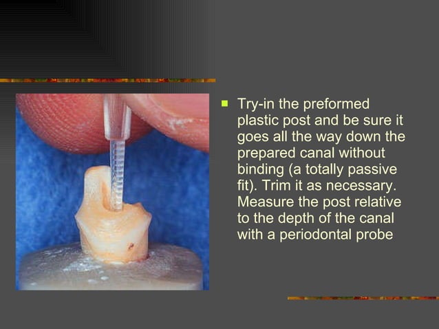 Post and core | PPT | Oral care | Personal Care