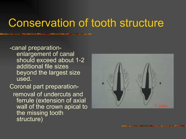 Post and core | PPT | Oral care | Personal Care