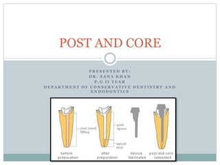 Post and core | PPTX
