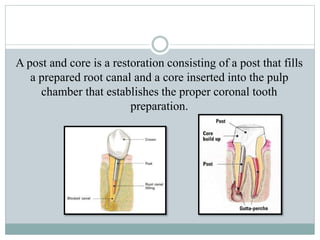 Post and core | PPTX