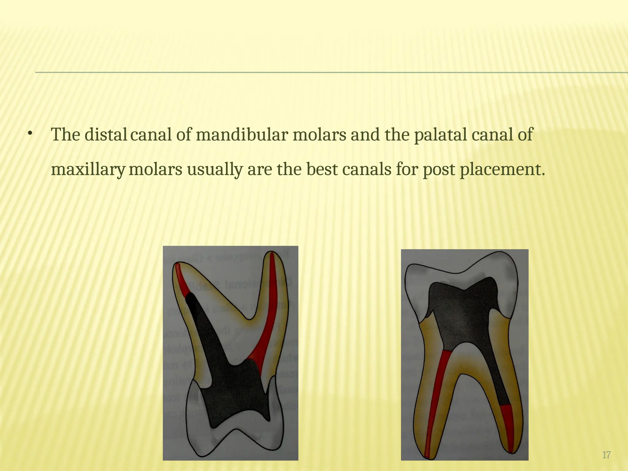 post and core implications in prosthodontics | PPTX