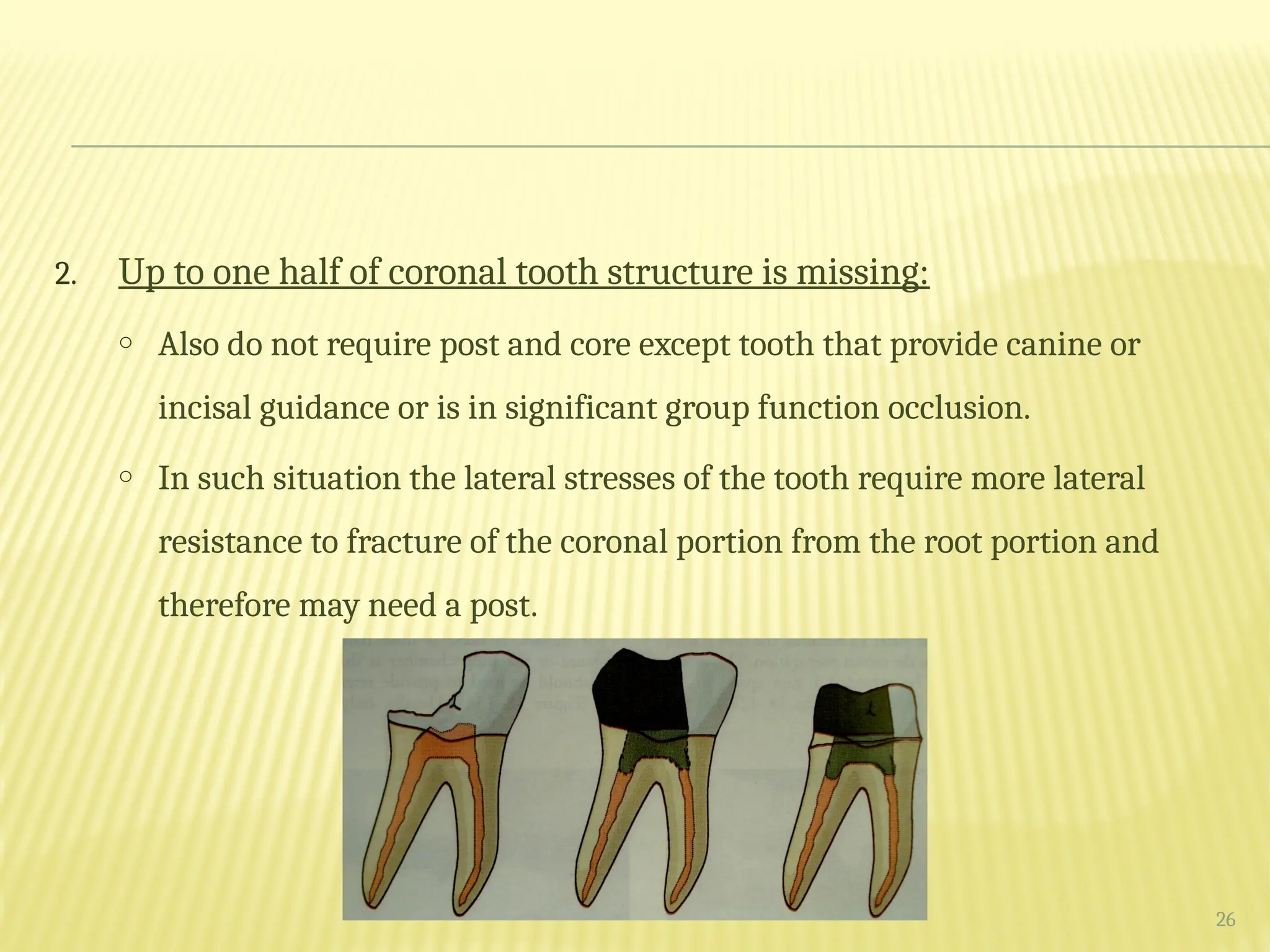 post and core implications in prosthodontics | PPTX