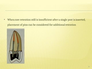 post and core implications in prosthodontics | PPTX