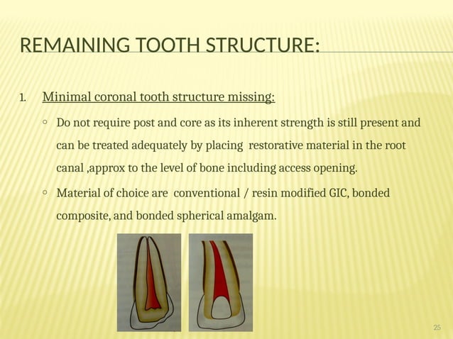 post and core implications in prosthodontics | PPTX | Dental Health ...