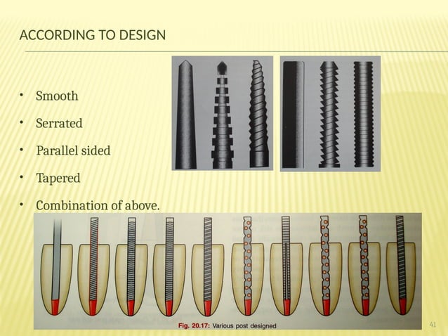post and core implications in prosthodontics | PPTX