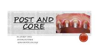 POST AND CORE | PPTX