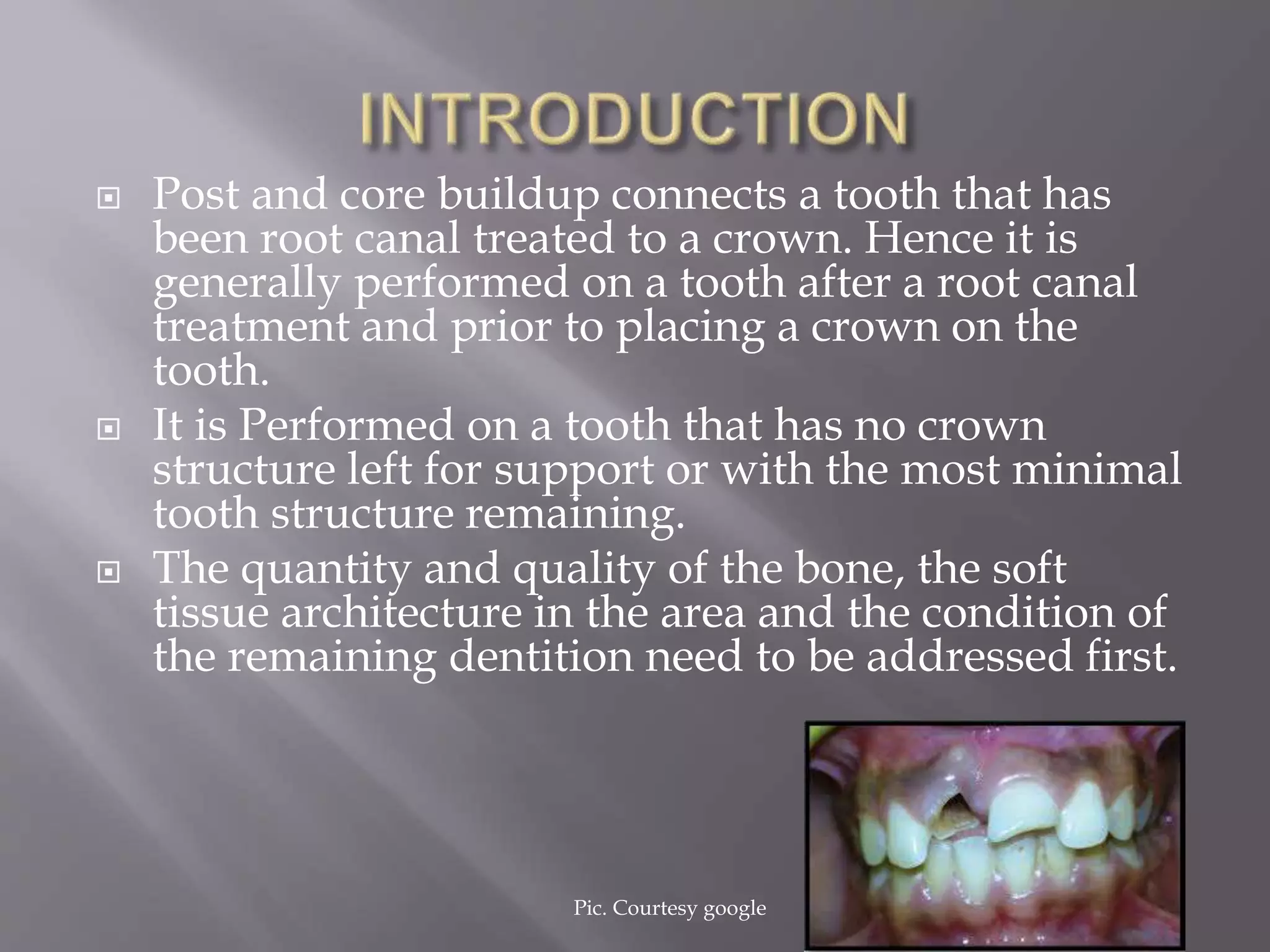 Post and core buildup | PPTX