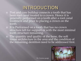 Post and core buildup | PPTX