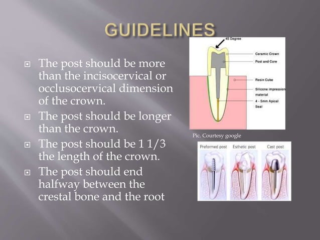 Post and core buildup | PPT