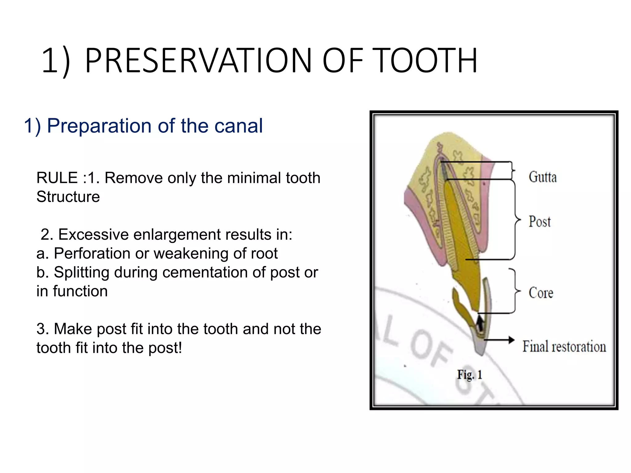 Post and core | PPTX
