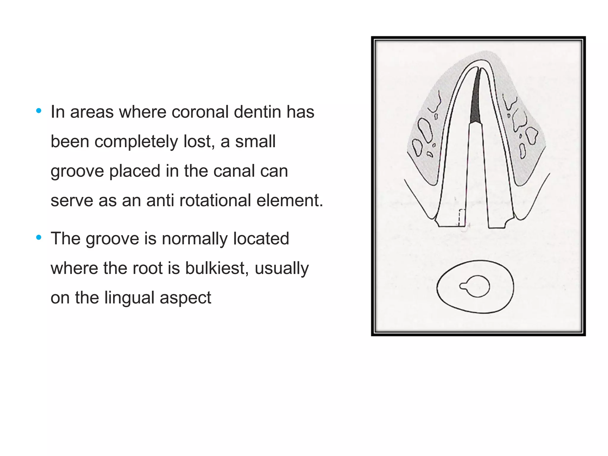 Post and core | PPTX