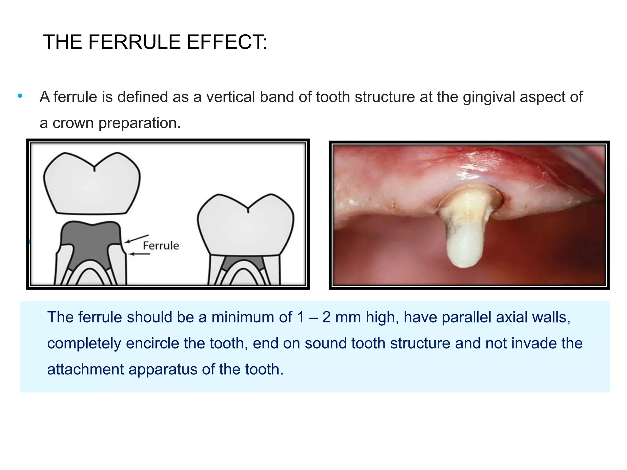 Post and core | PPTX