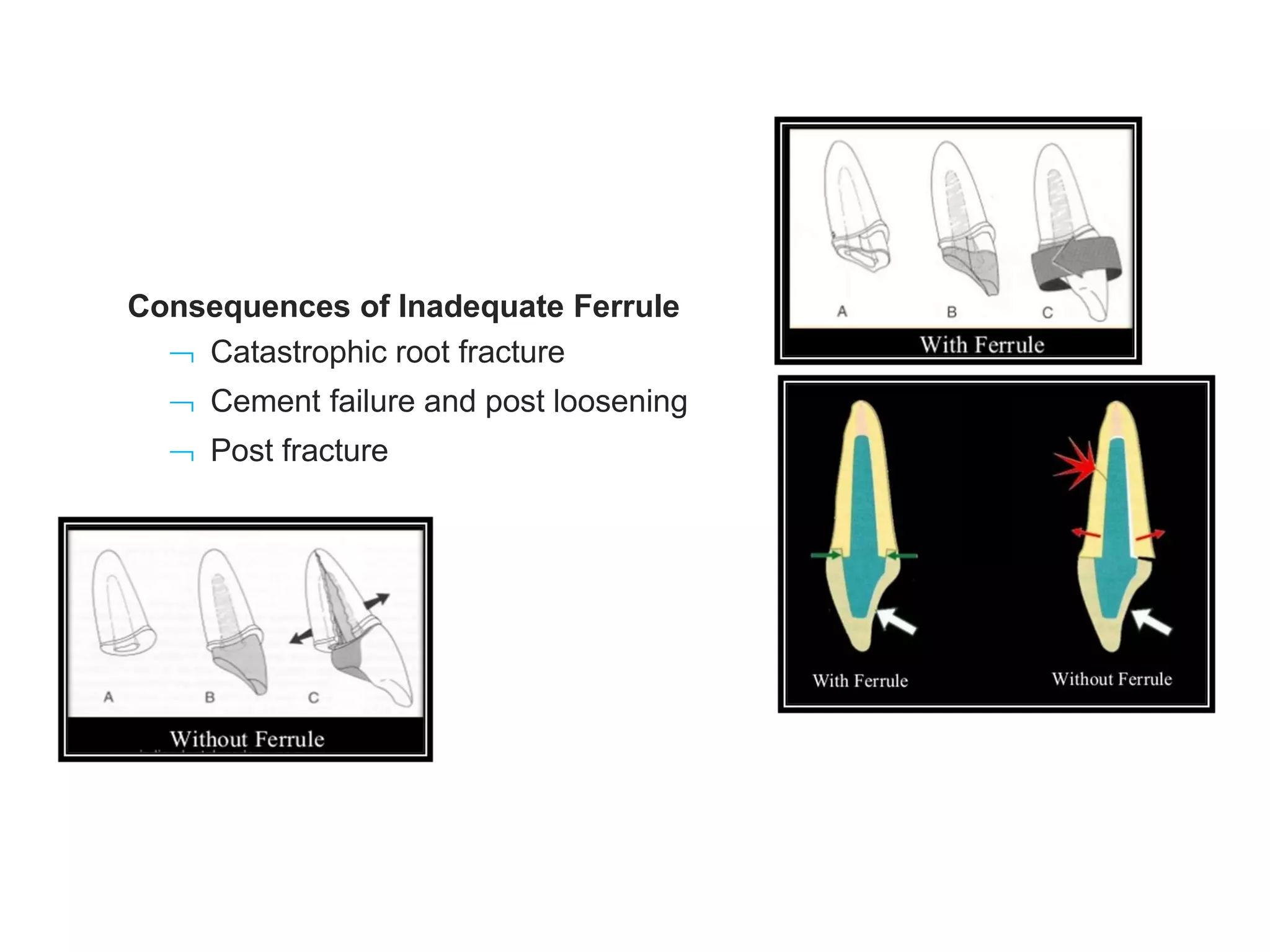 Post and core | PPTX
