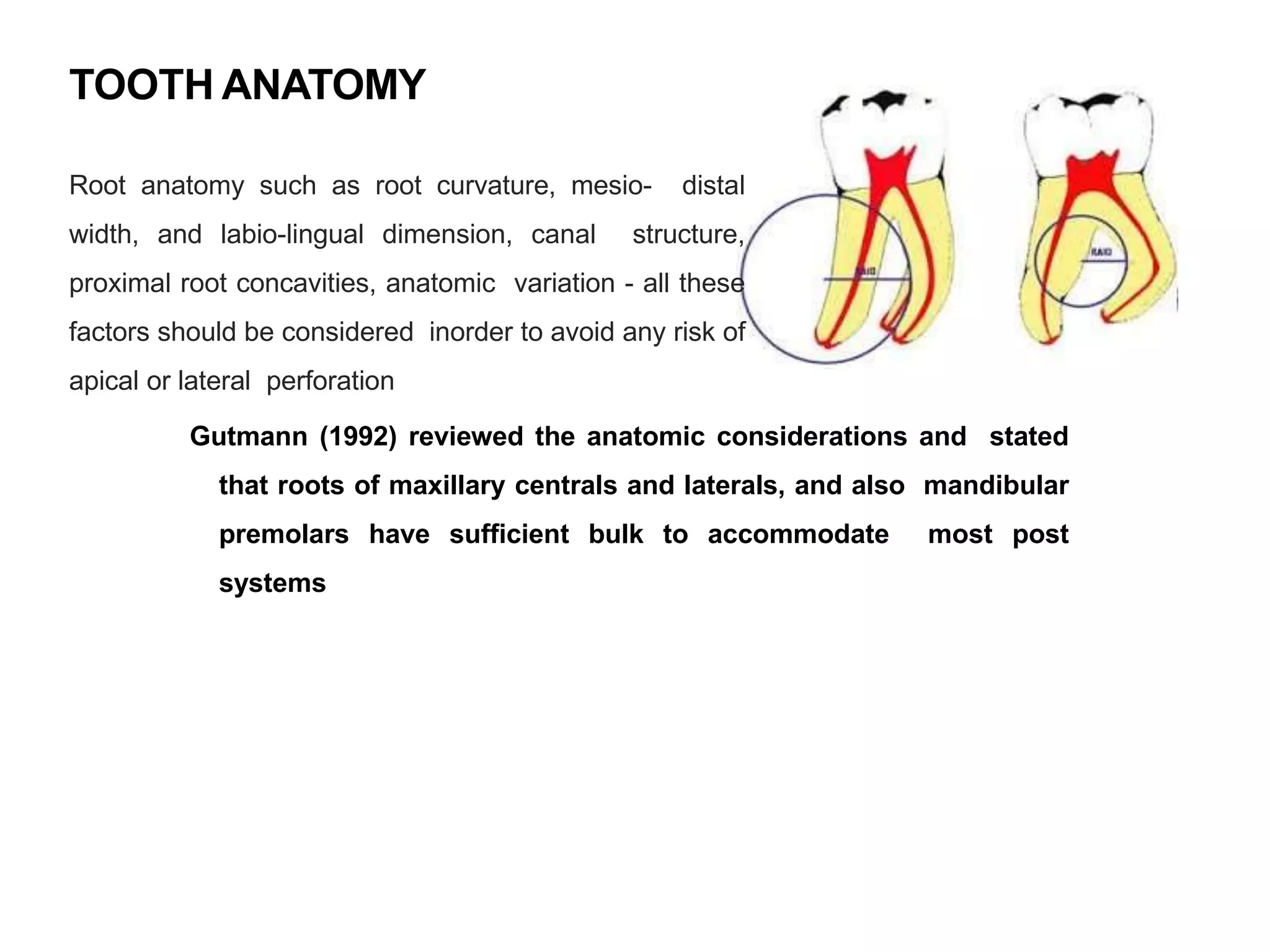 Post and core | PPTX