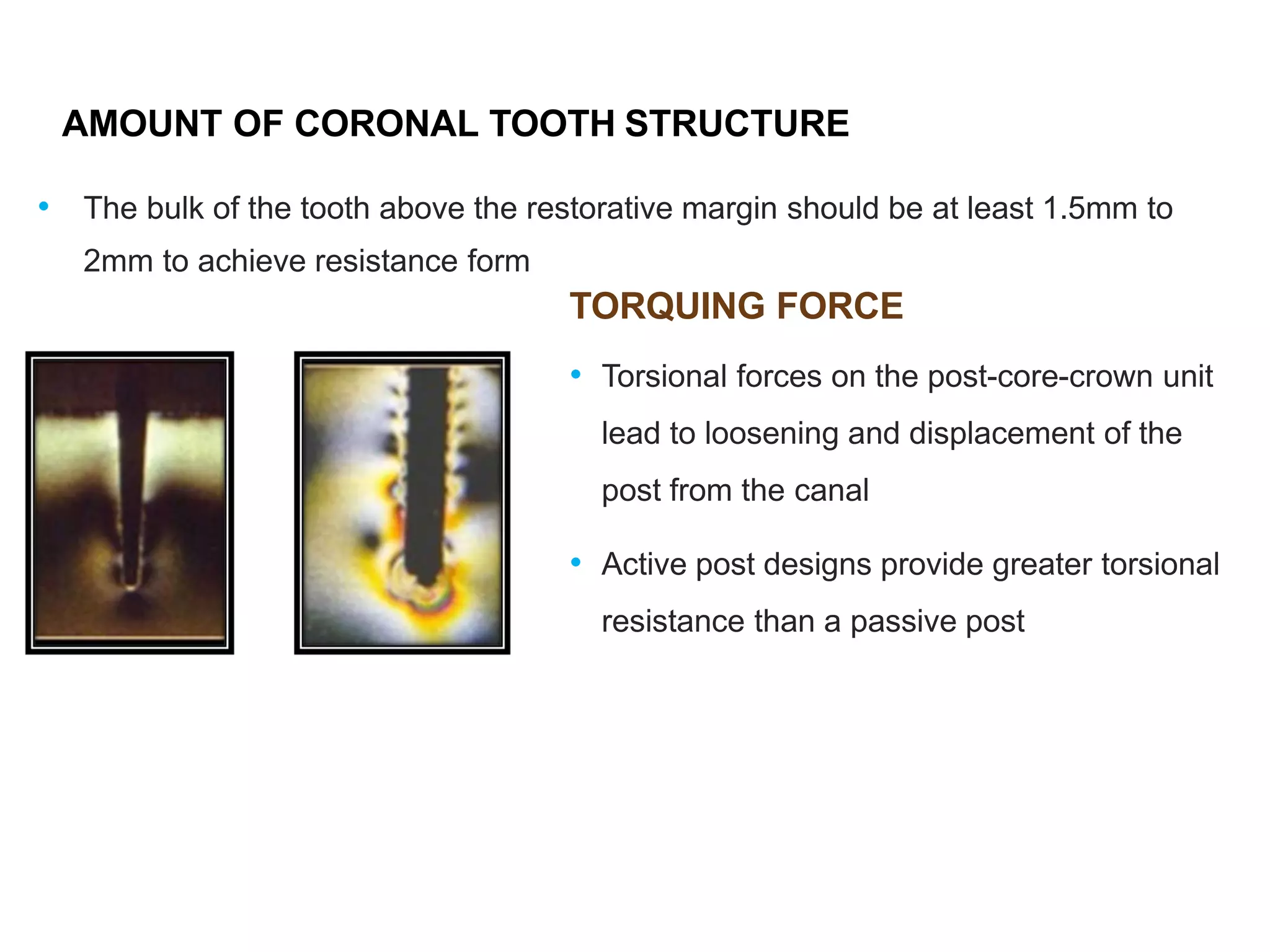 Post and core | PPTX