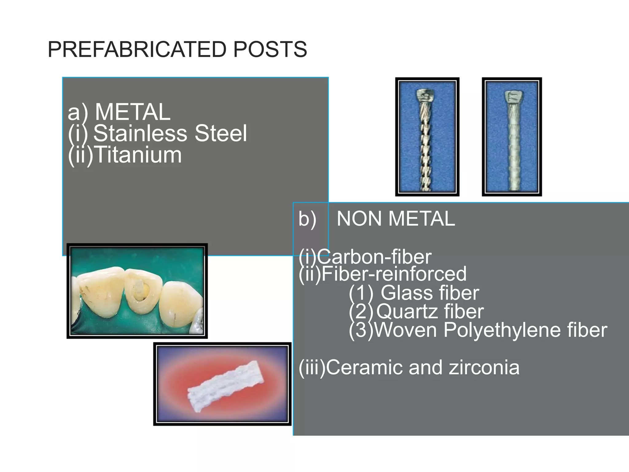 Post and core | PPTX