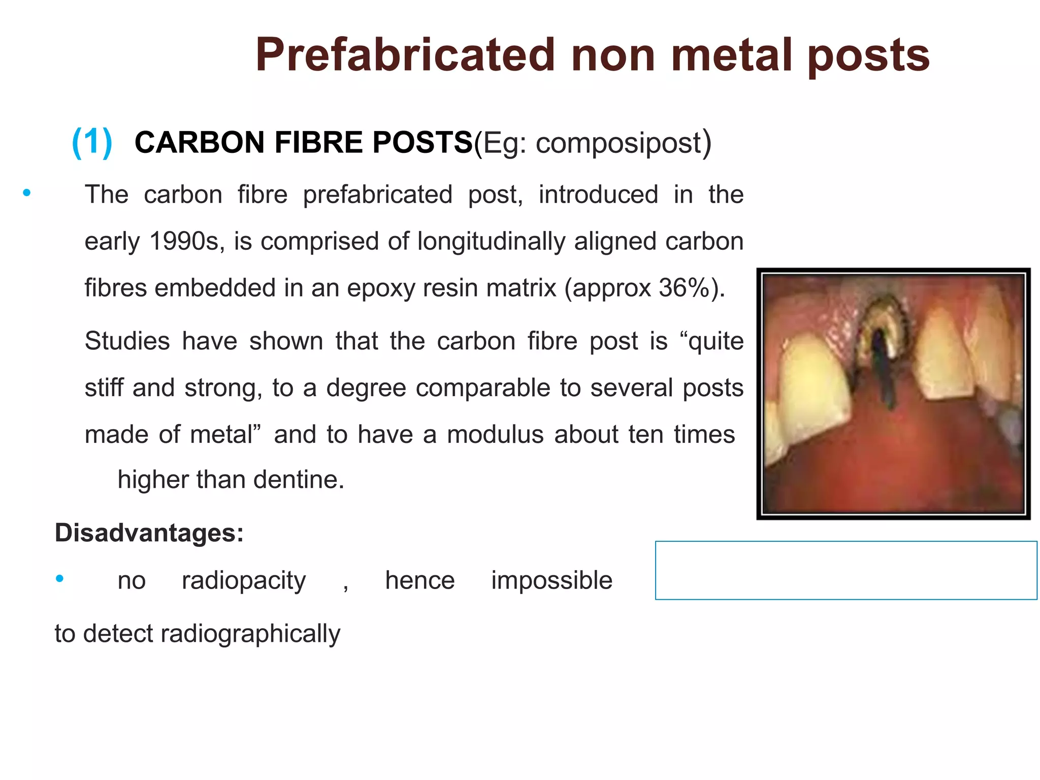 Post and core | PPTX
