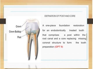 Post and core | PPTX