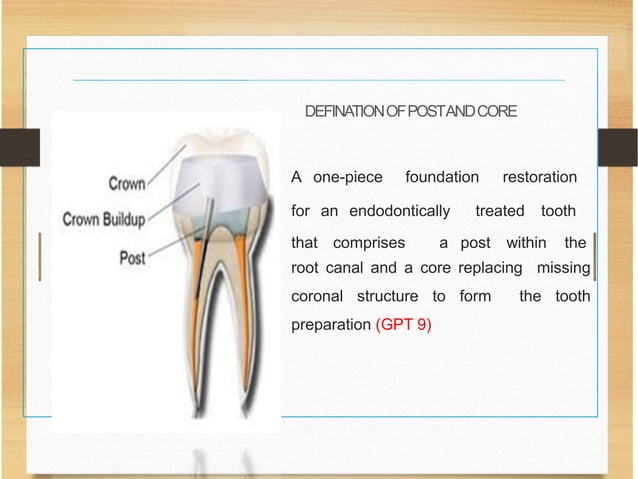 Post and core | PPTX | Dental Health | Diseases and Conditions