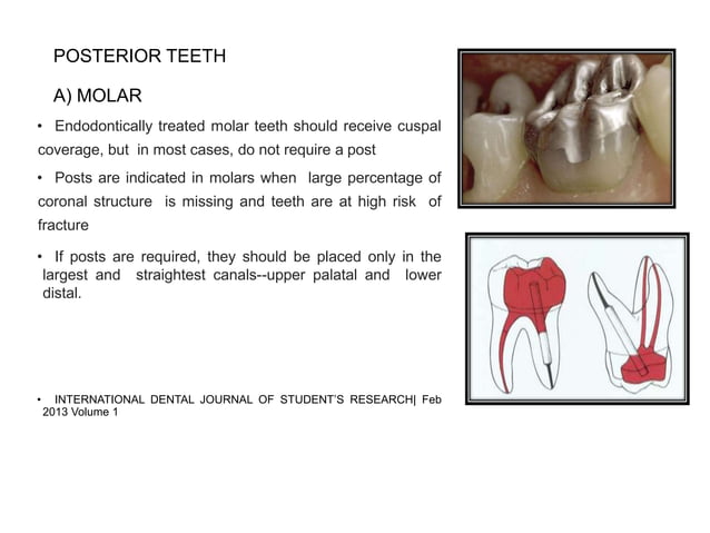 Post and core | PPTX | Dental Health | Diseases and Conditions