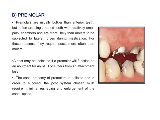 Post and core | PPTX | Dental Health | Diseases and Conditions